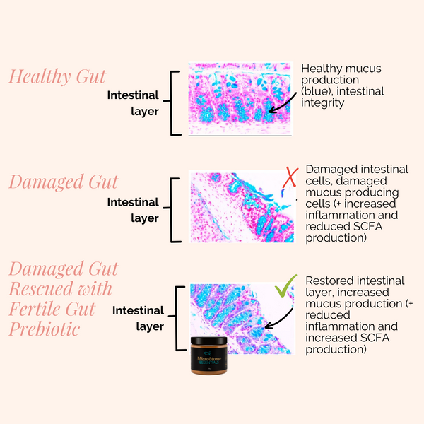 Ultimate Gut-Nurturing Duo – Fertile Gut