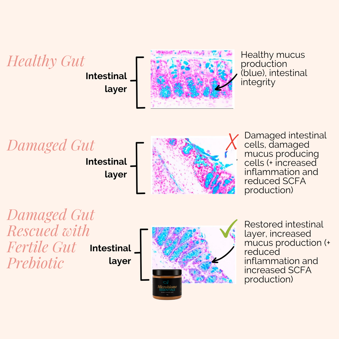 Ultimate Gut-Nurturing Duo – Fertile Gut